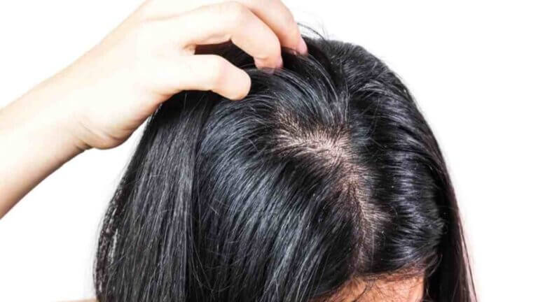 Penyebab dan Cara Mengatasi Rambut Lepek dan Berminyak – Green Angelica